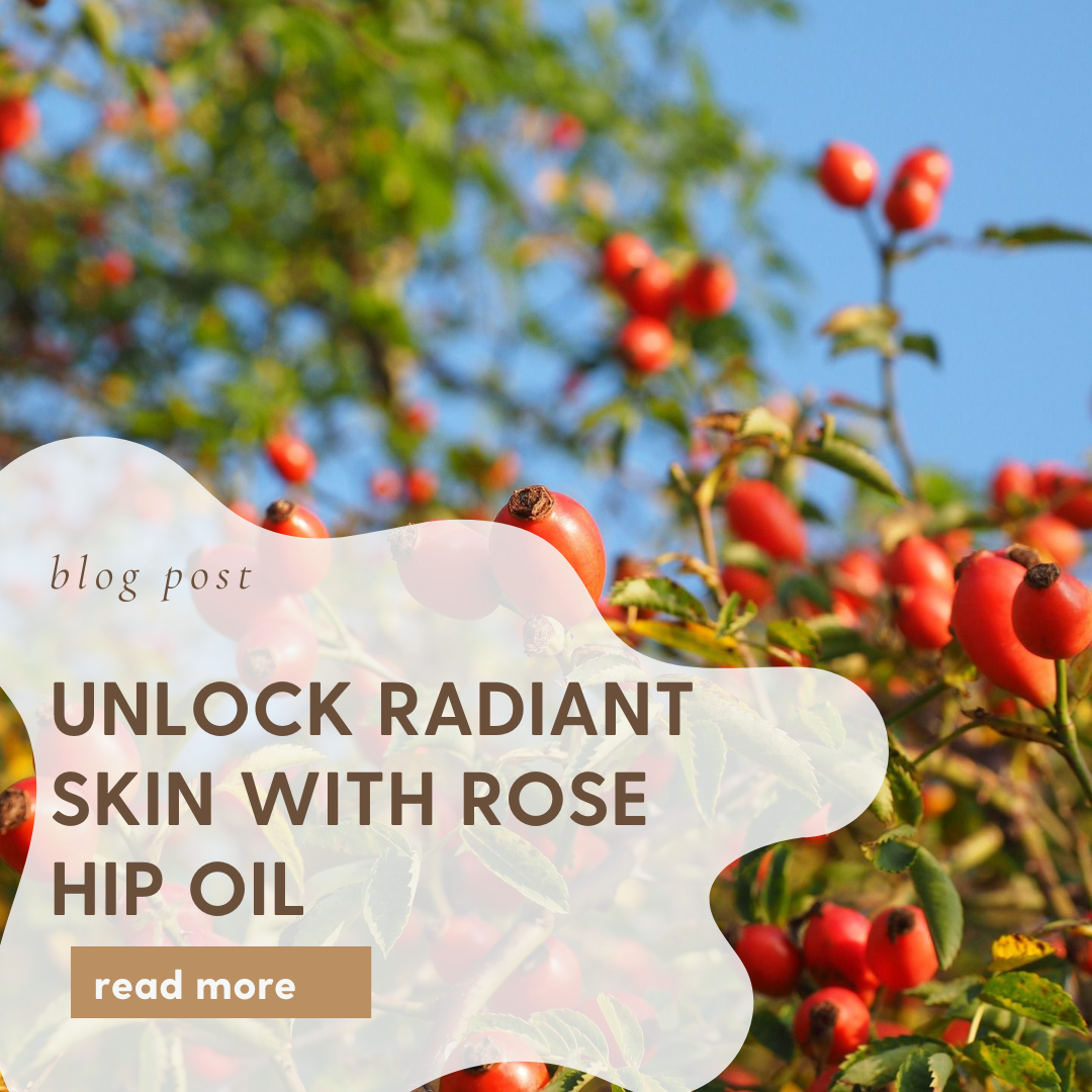 Unlock Radiant Skin with Rose Hip Facial Oil – Calhoun Farm